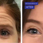 dermani MEDSPA® | Voted #1 Best Medical Spa Near Me