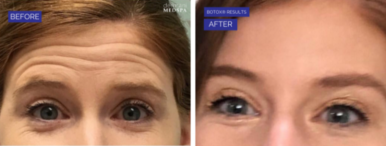 dermani MEDSPA® | Voted #1 Best Medical Spa Near Me