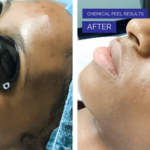 dermani MEDSPA® | Voted #1 Best Medical Spa Near Me