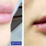 dermani MEDSPA® Atlanta | Voted #1 Best Medical Spa Near Me