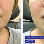 dermani MEDSPA® | Voted #1 Best Medical Spa Near Me