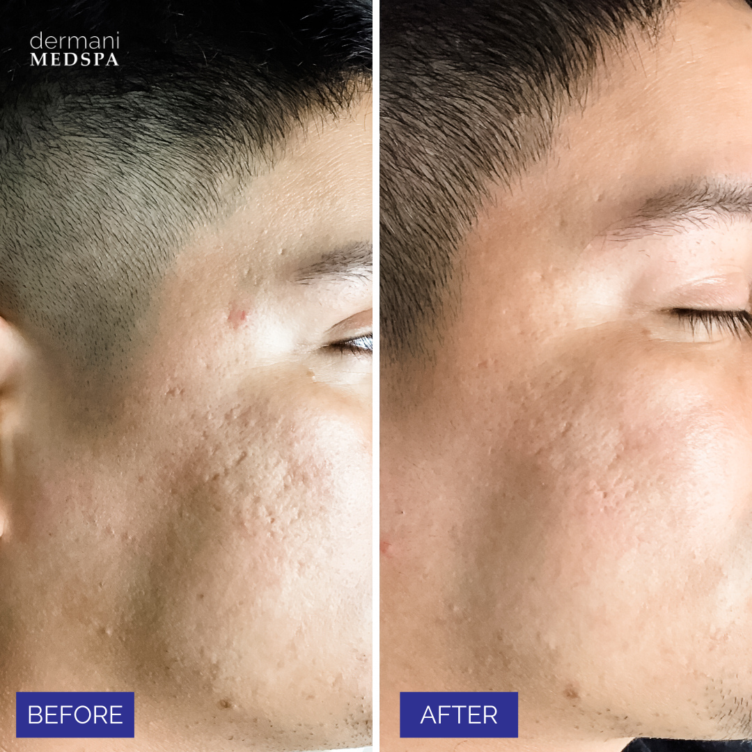 dermani MEDSPA® Vinings Services | Best Med Spa Near Me