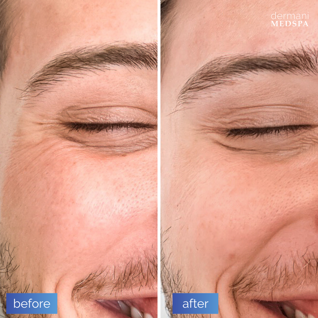 dermani MEDSPA® Vinings Services | Best Med Spa Near Me