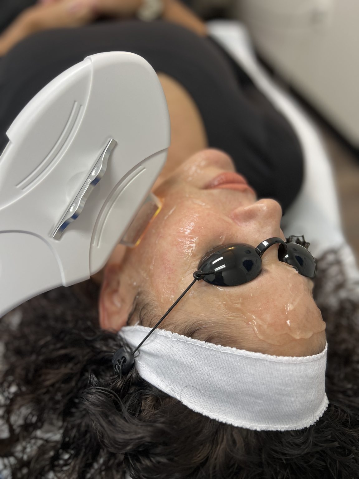 Achieving Clearer Skin: How dermani MEDSPA® Services Complement Emrosi ...